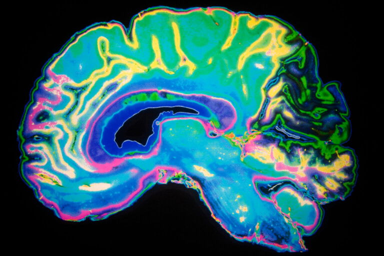 Elektromagnes – budowa, działanie i zastosowanie • FORBOT